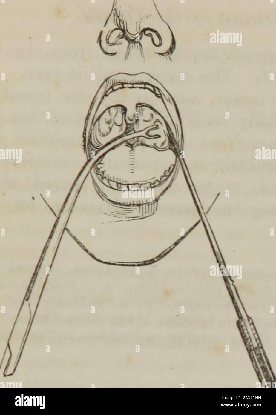 Silver nitrate zinc hi-res stock photography and images - Alamy