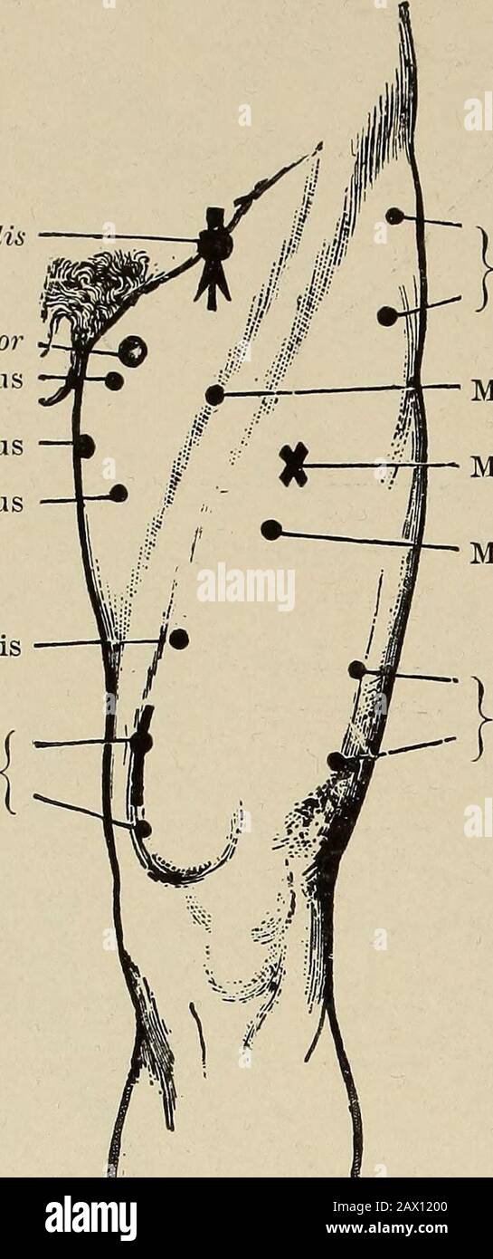 Cathodal hi-res stock photography and images - Alamy