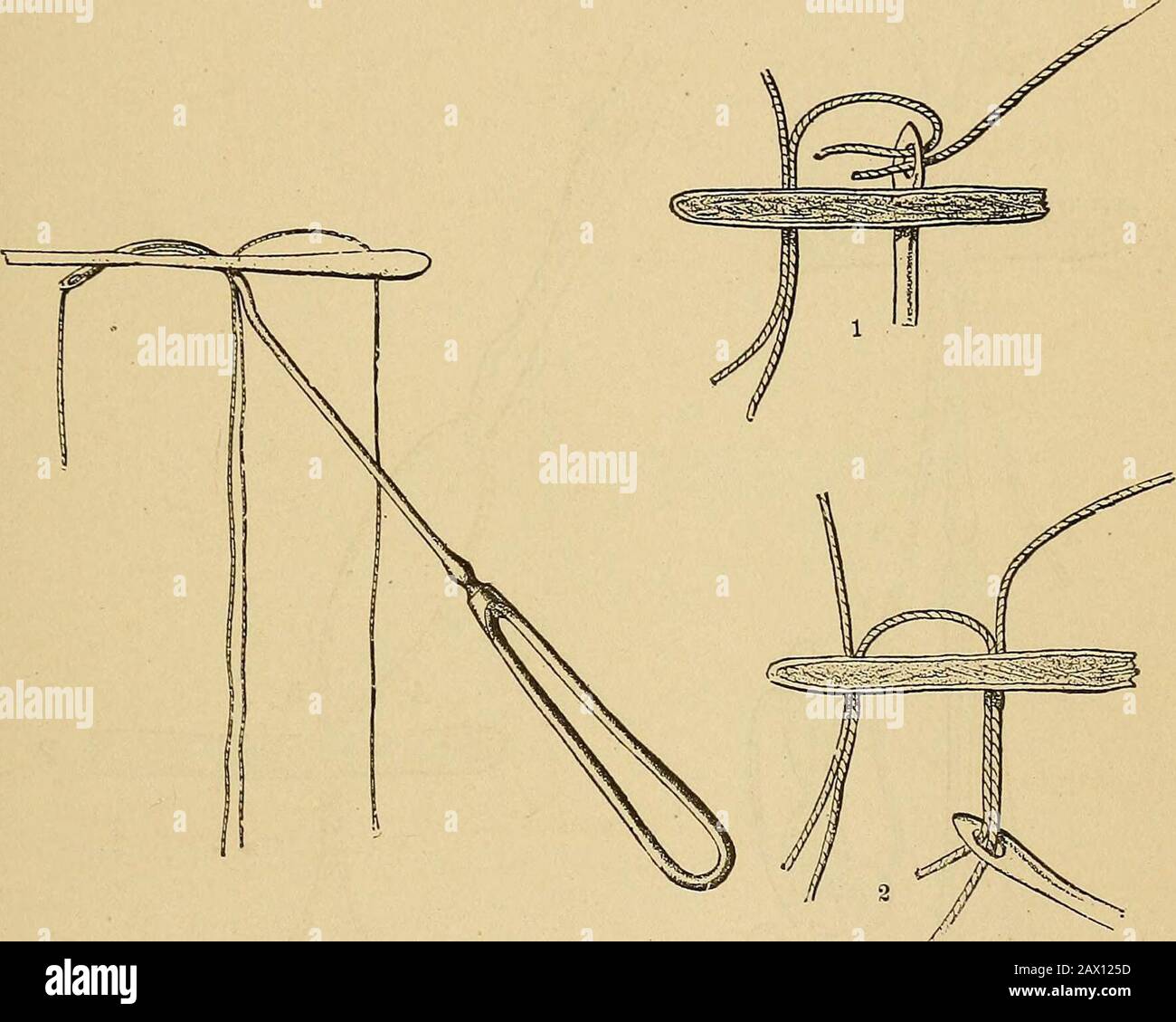 Twisted suture hi-res stock photography and images - Alamy