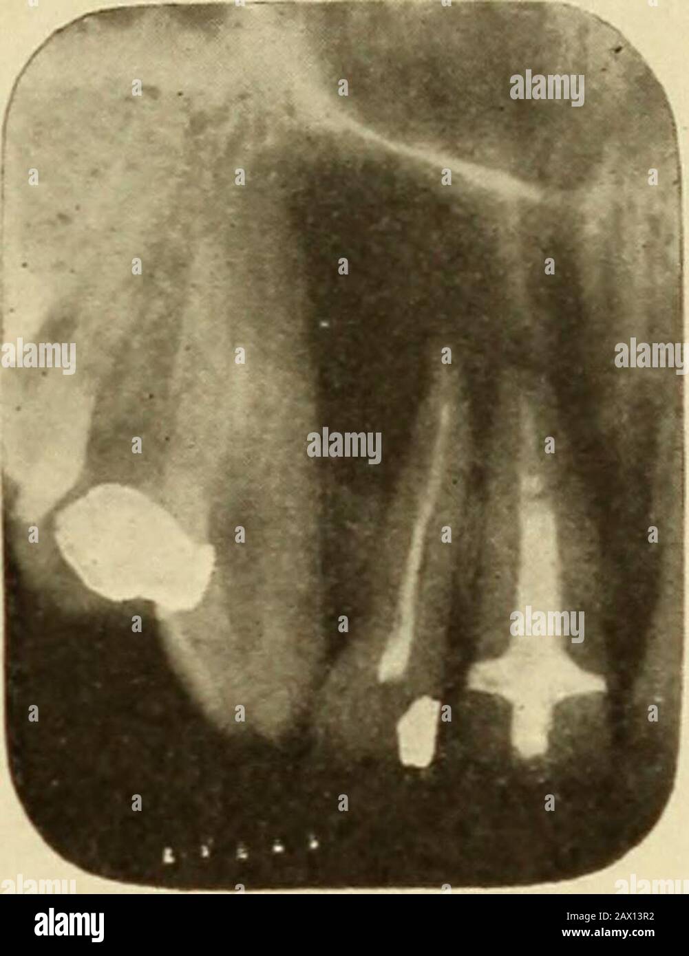 Diseases of the soft structures of the teeth and their treatment; a ...