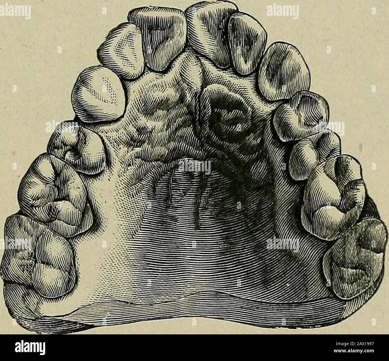 The etiology of osseous deformities of the head, face, jaws and teeth ...