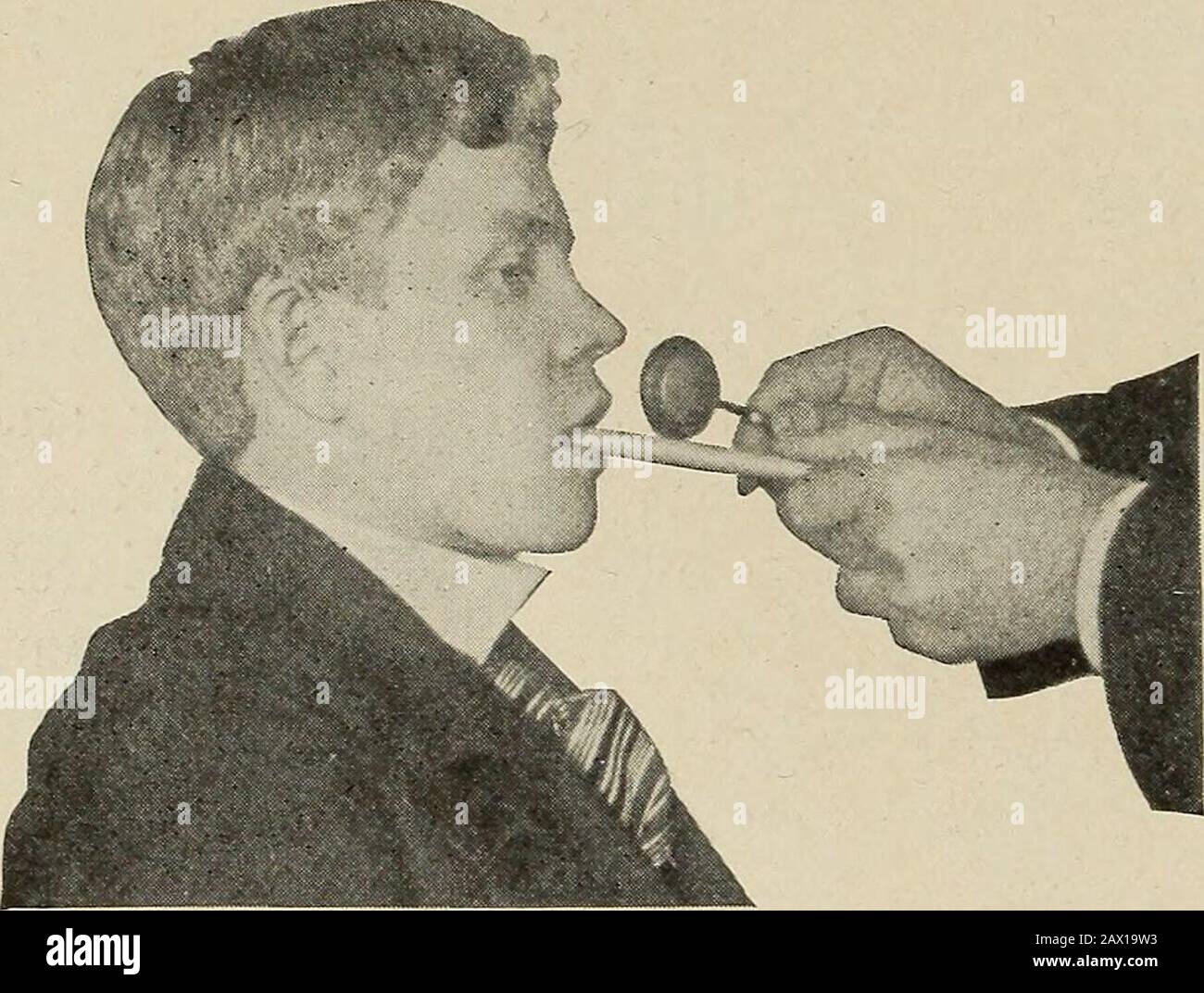 Jaw jerk reflex hi-res stock photography and images - Alamy