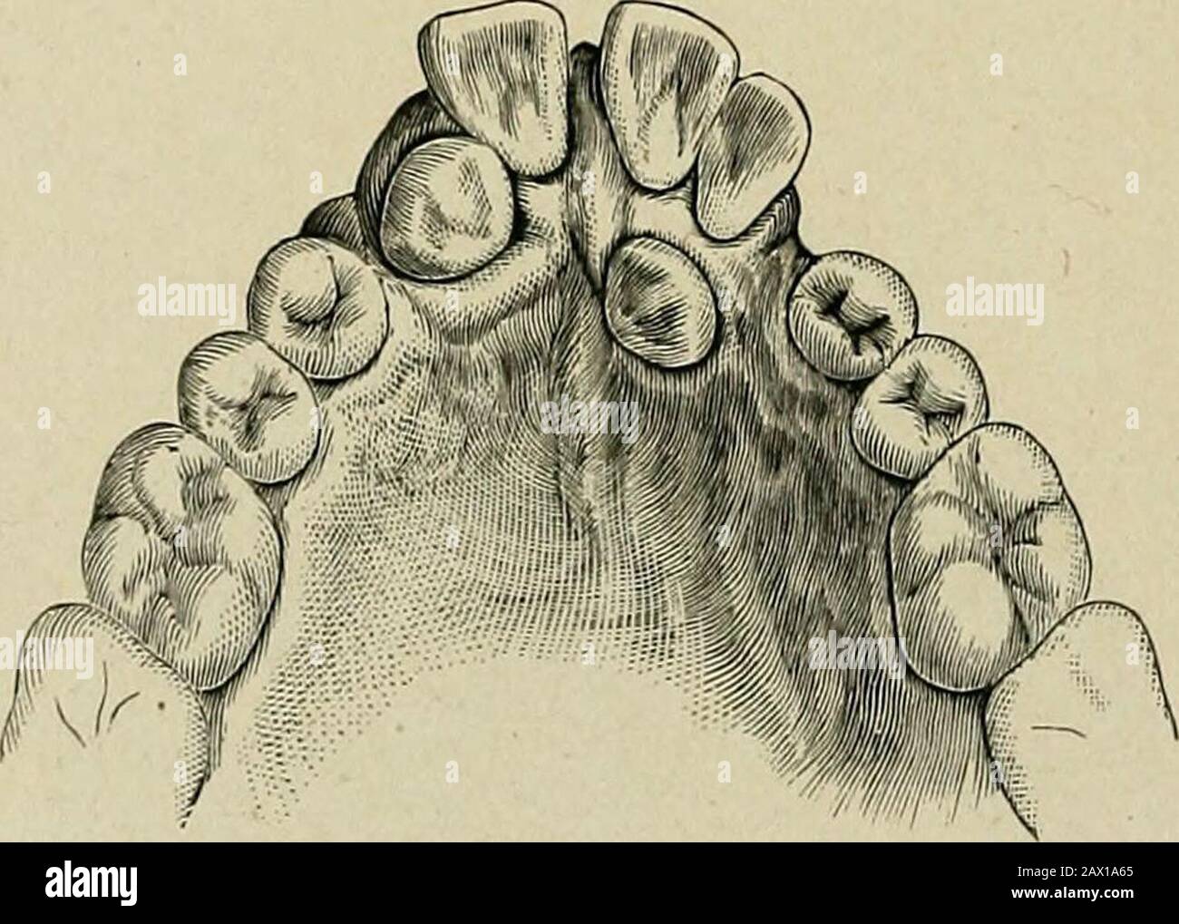 The etiology of osseous deformities of the head, face, jaws and teeth ...