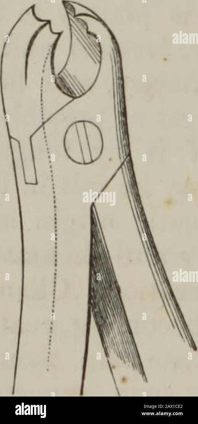 Operative procedure hi-res stock photography and images - Alamy