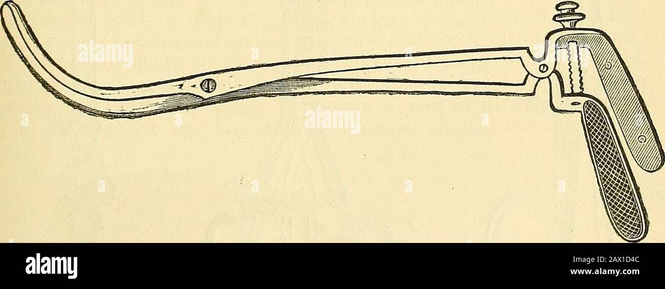 Minor surgical gynecology : a manual of uterine diagnosis and the ...