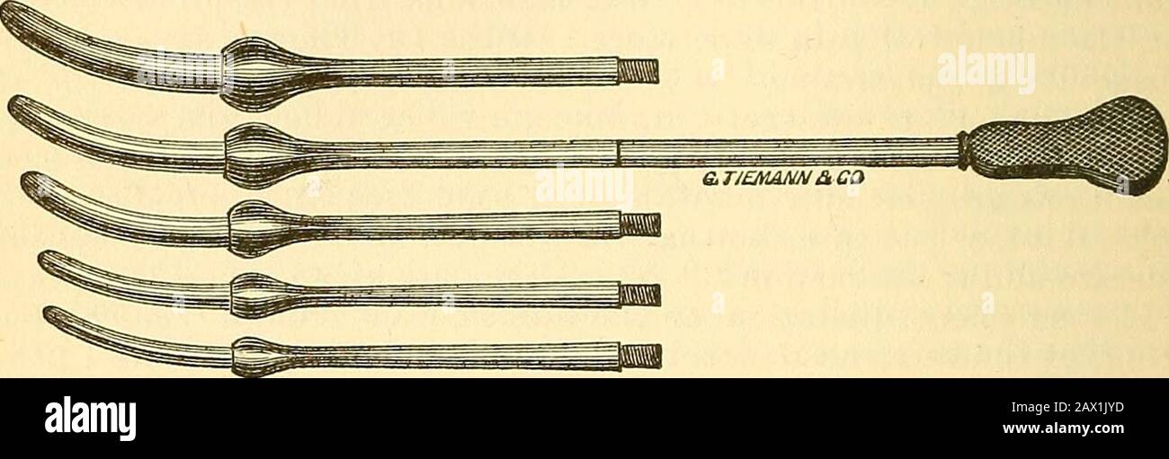 Minor surgical gynecology : a manual of uterine diagnosis and the ...