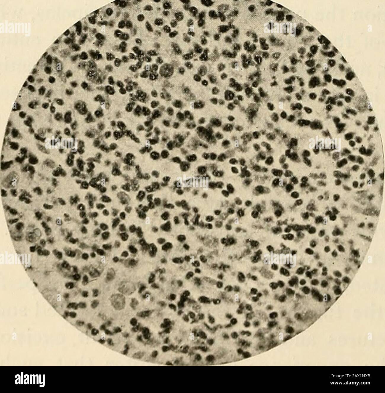 The pathology and surgical treatment of tumors . ther pain ...