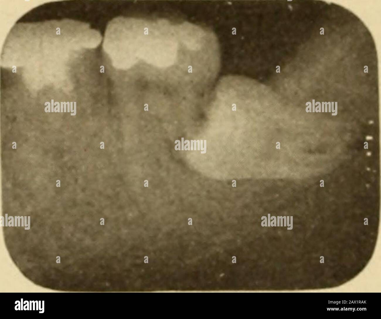 Diseases of the soft structures of the teeth and their treatment; a ...