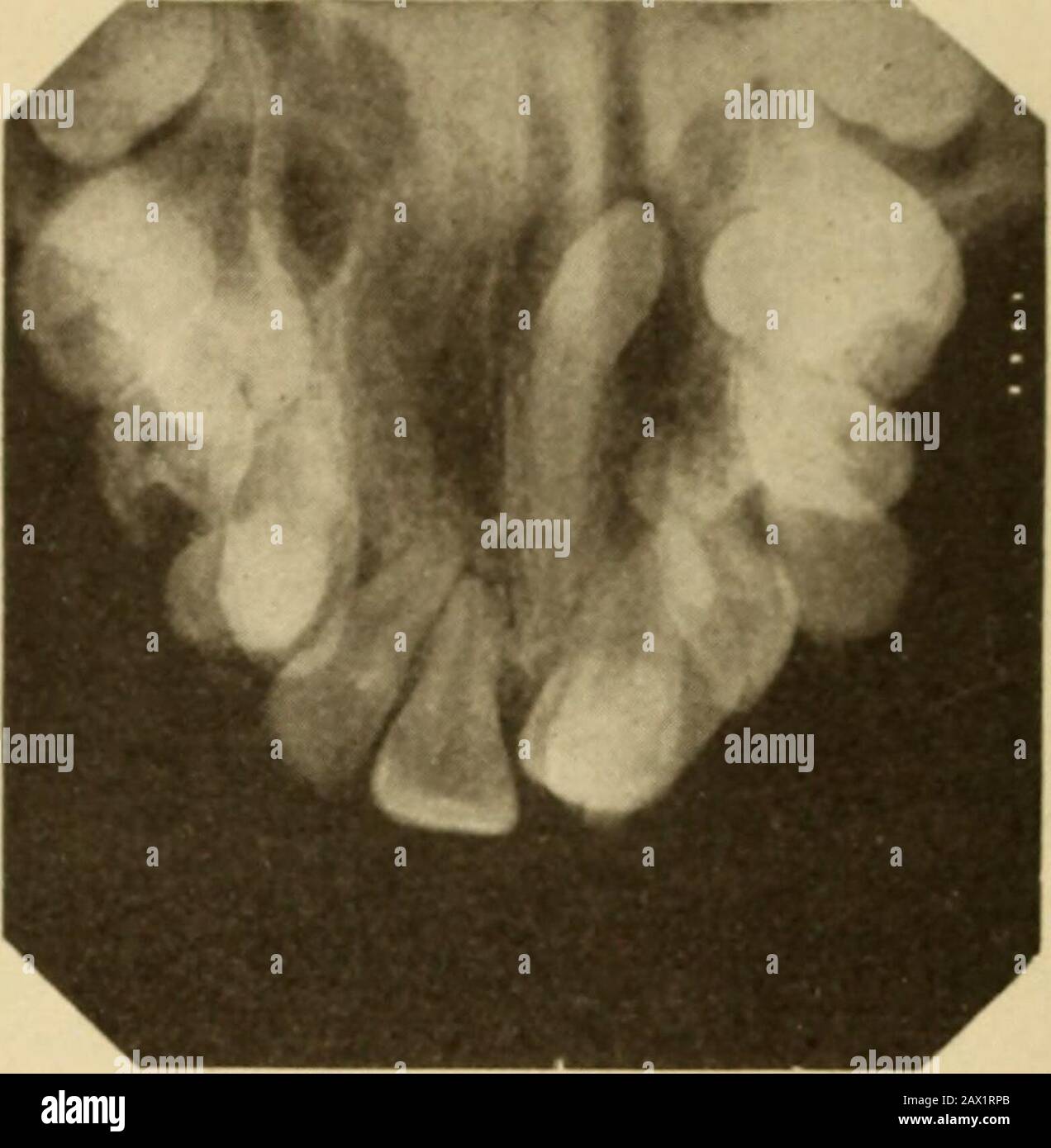 Diseases of the soft structures of the teeth and their treatment; a ...
