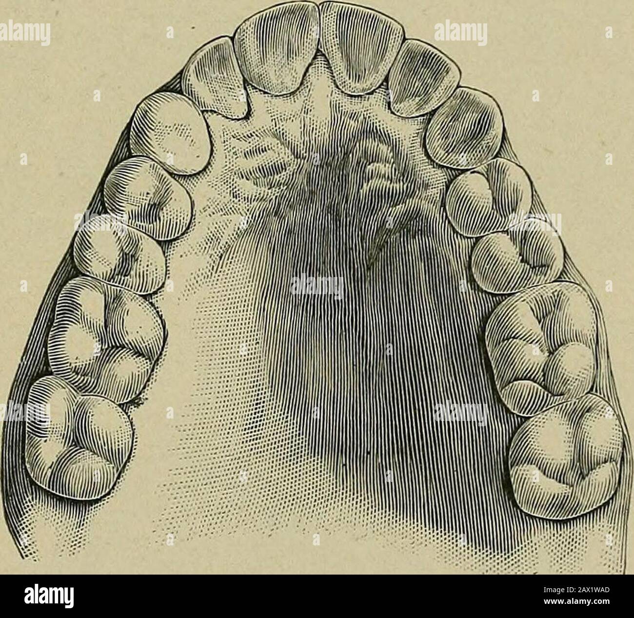 Alveolar process of maxilla hi-res stock photography and images - Alamy