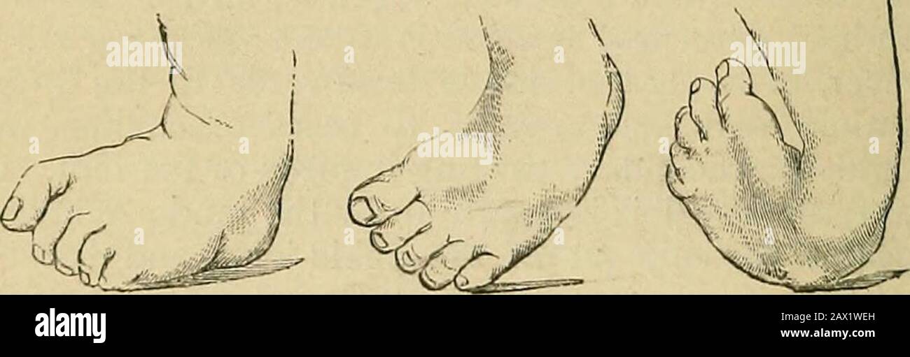 Talip hi-res stock photography and images - Alamy