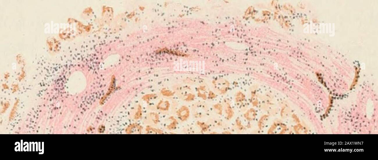 Interlobular ducts hi-res stock photography and images - Alamy