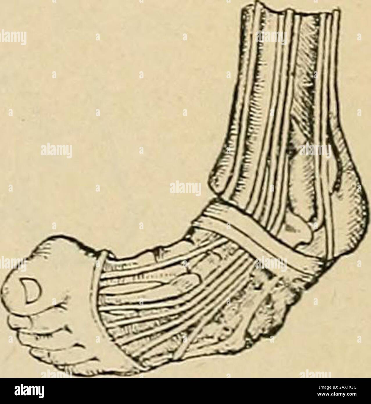 Deformed tube hi-res stock photography and images - Alamy