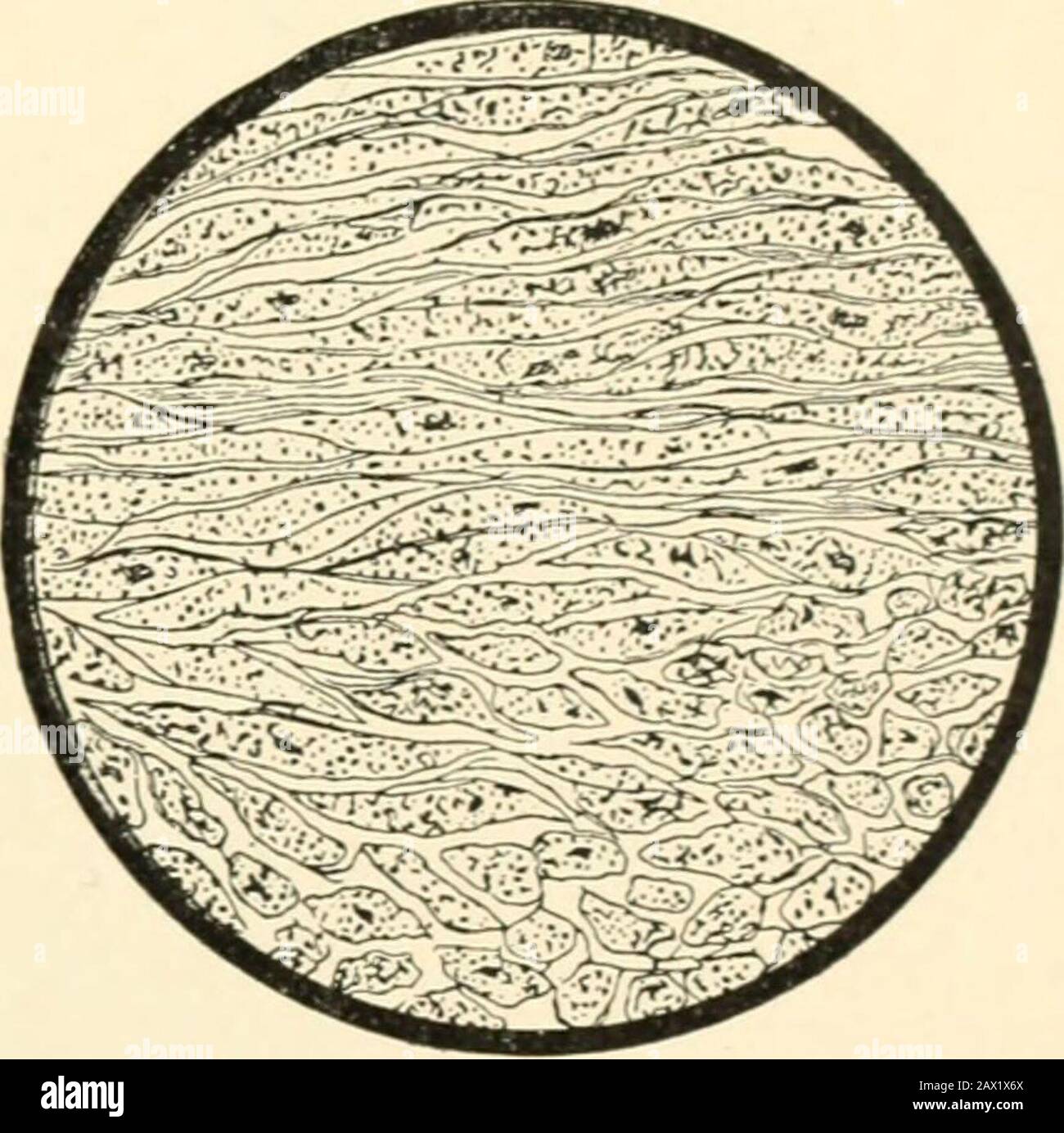 A textbook of obstetrics . Fig. 193.—Muscular tissue of the pregnant ...