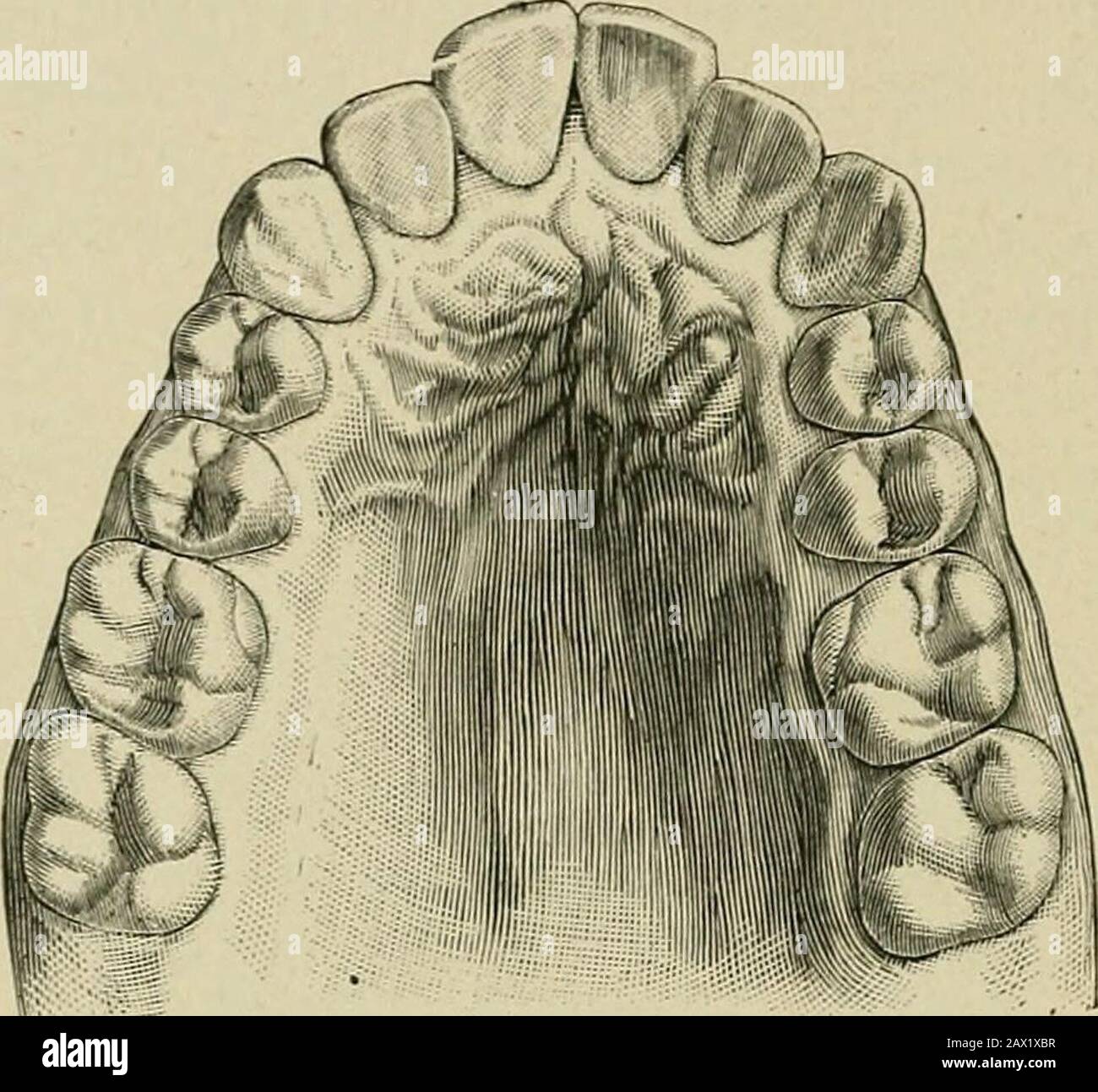 The etiology of osseous deformities of the head, face, jaws and teeth ...