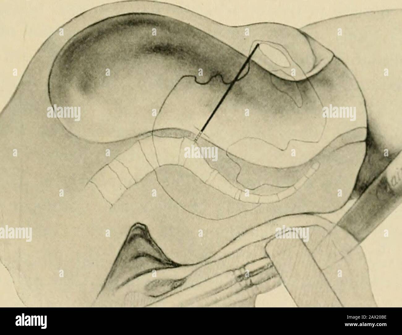 The American text-book of obstetrics for practitioners and students ...
