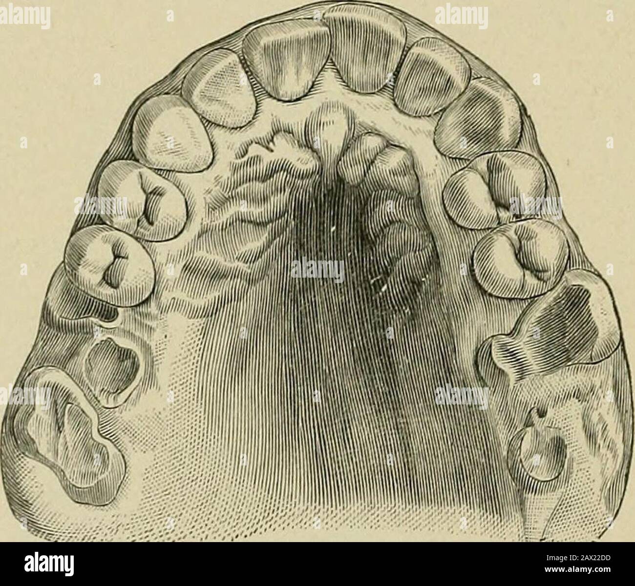 The etiology of osseous deformities of the head, face, jaws and teeth ...