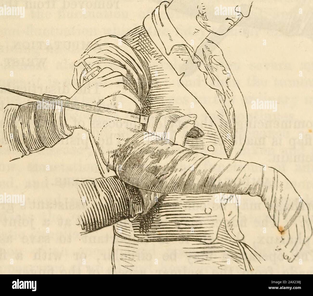 A hand-book of surgery: with fifty illustrations . If the knife is held ...