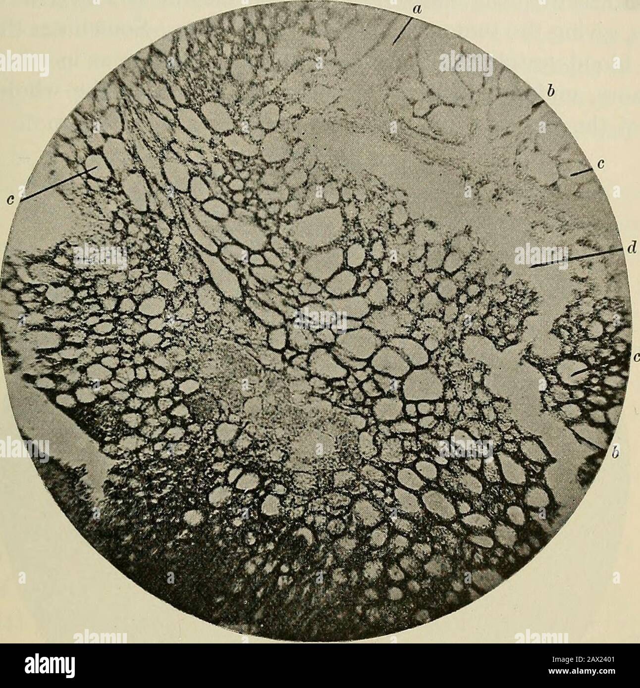 The pathology and surgical treatment of tumors . sue recticulum, from ...