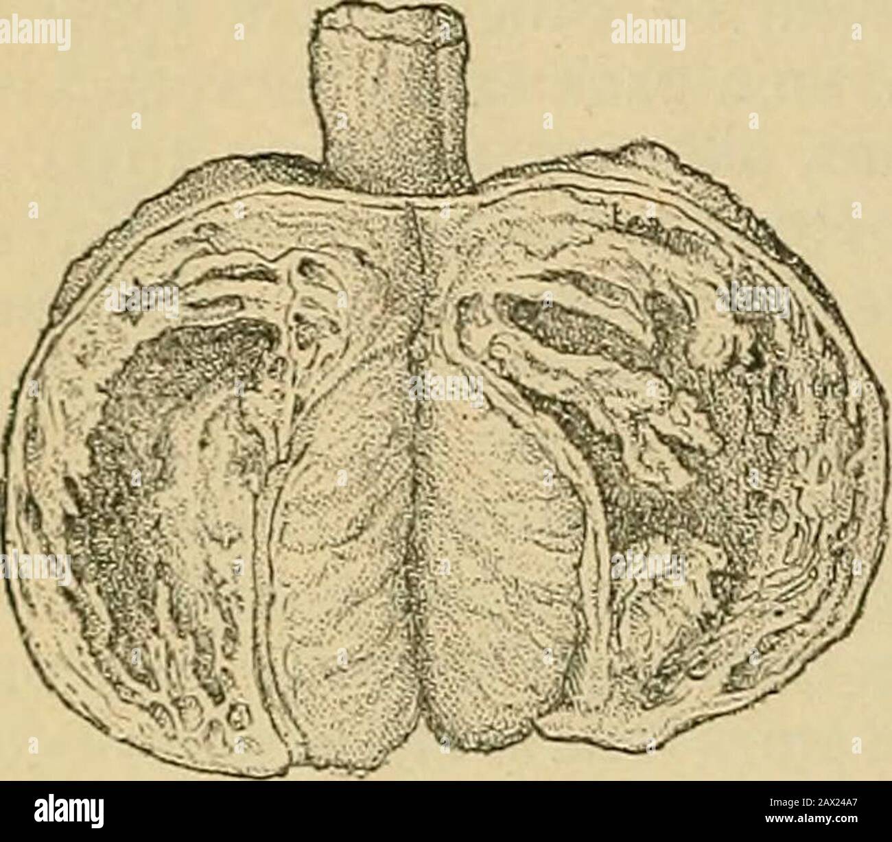 Closely twisted hi-res stock photography and images - Alamy