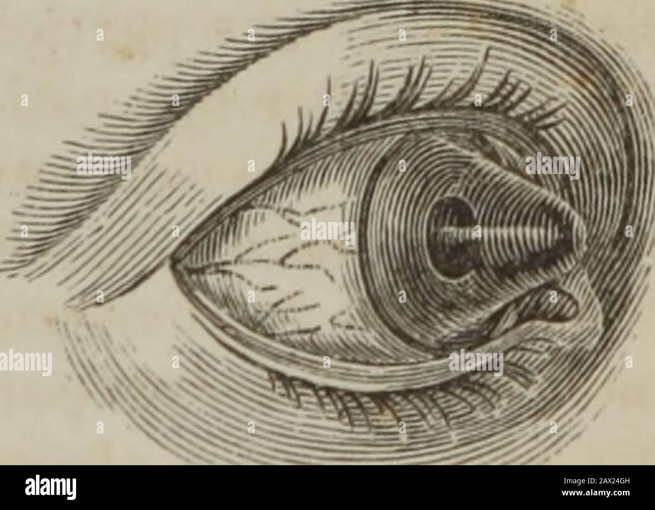 Aqueous humor hi-res stock photography and images - Alamy