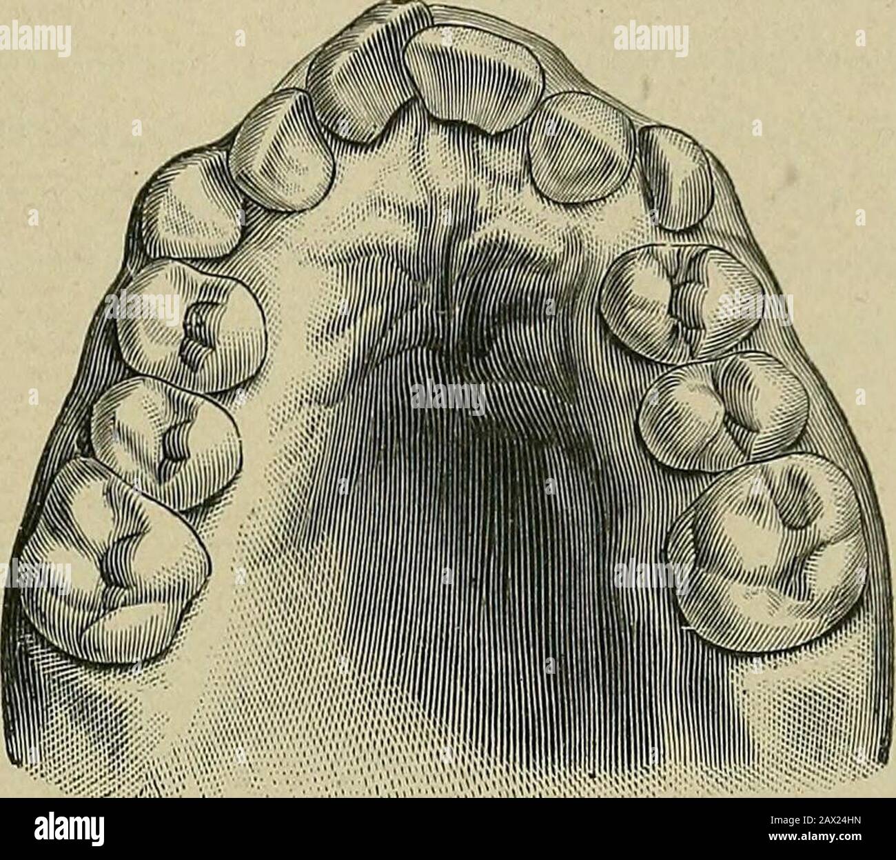Defective Teeth High Resolution Stock Photography and Images - Alamy