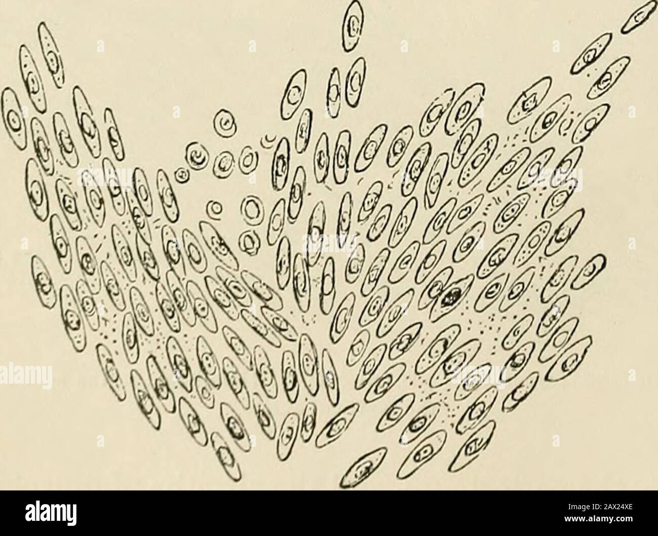 Spindle cell tumors hi-res stock photography and images - Alamy