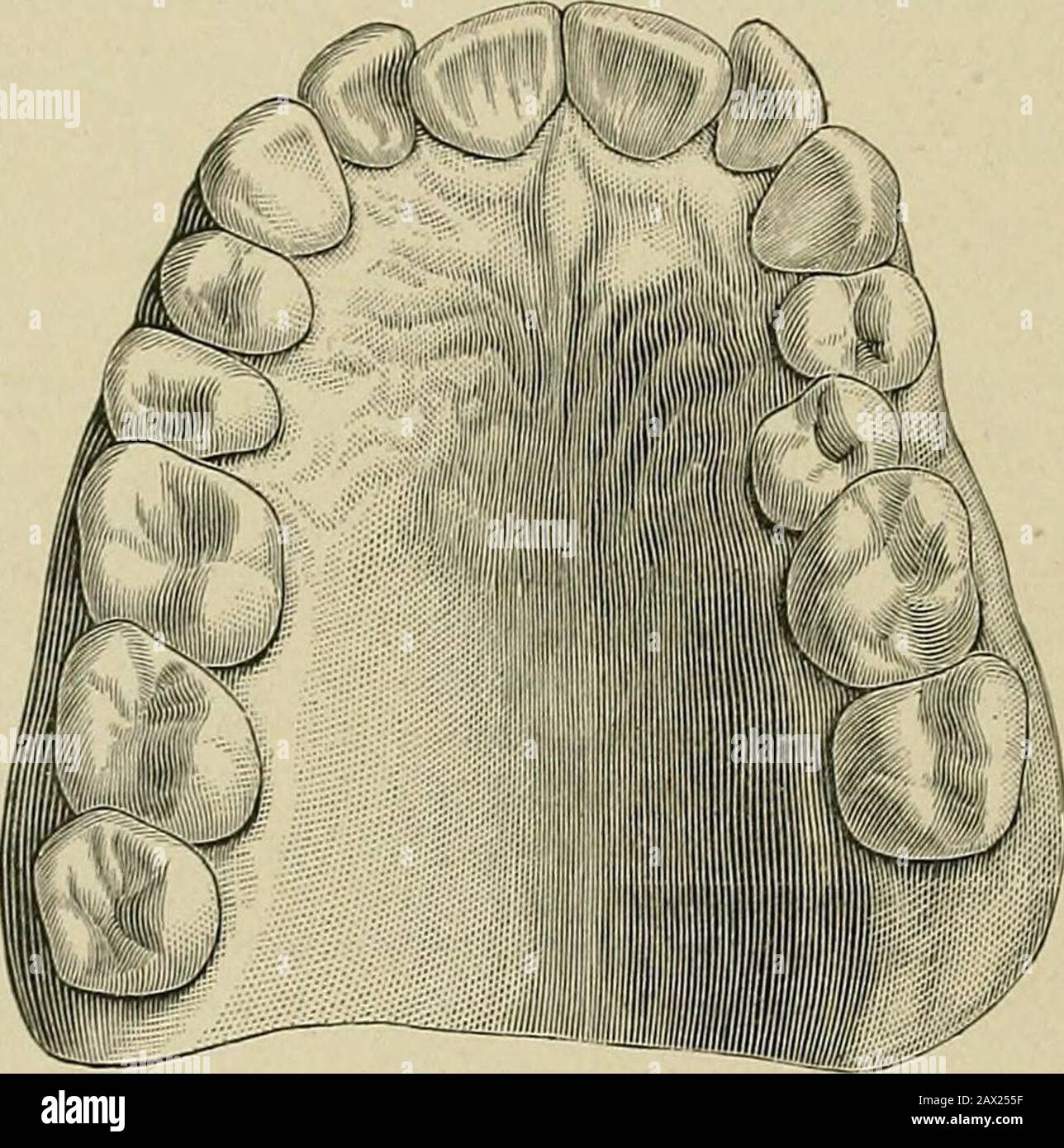Alveolar process of maxilla hi-res stock photography and images - Alamy