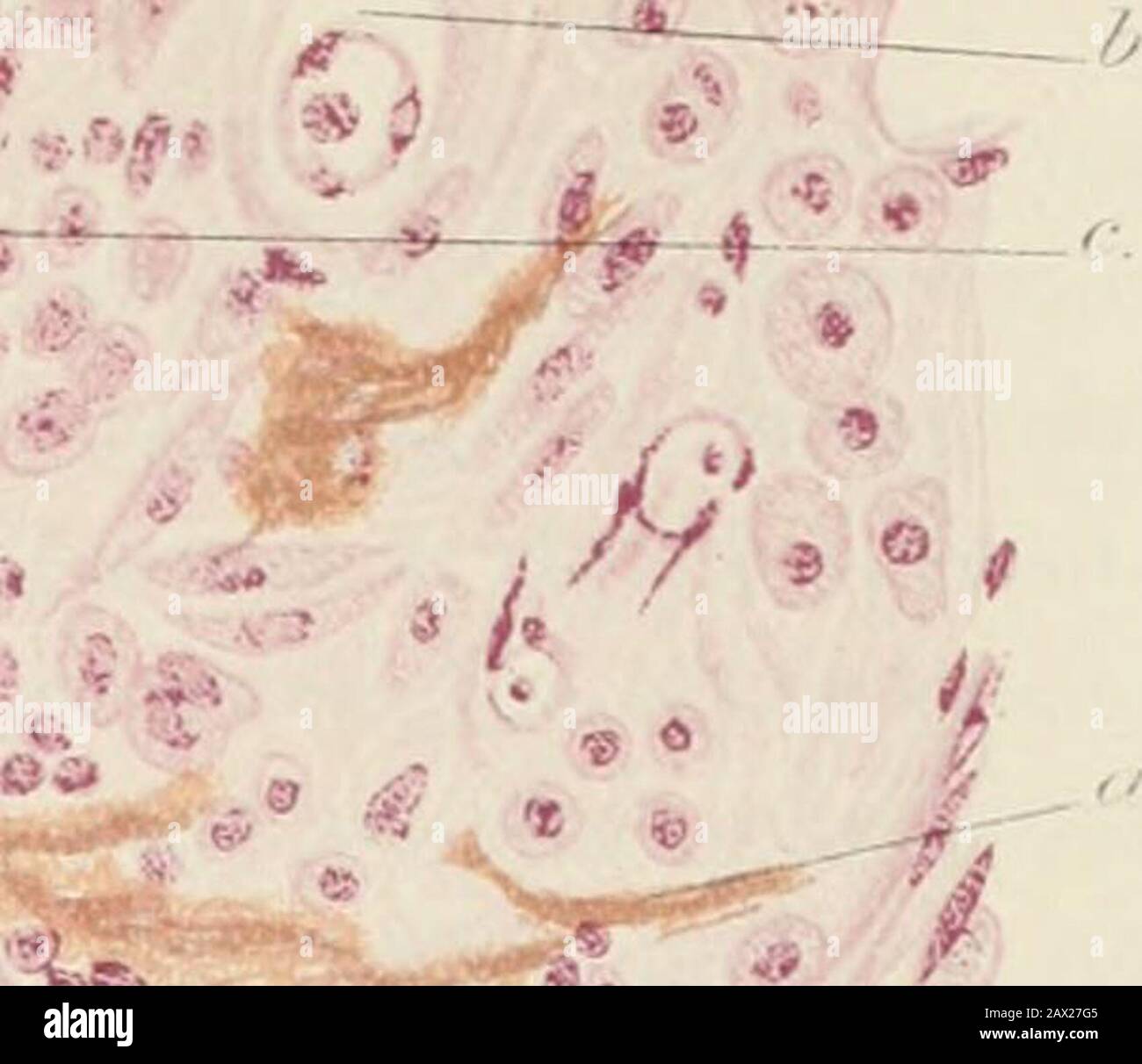 Reticulum Stain Example: Reticulum