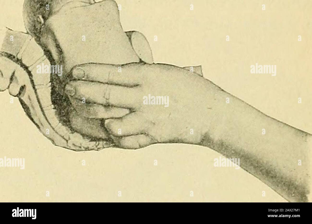 Breech fetus hi-res stock photography and images - Alamy