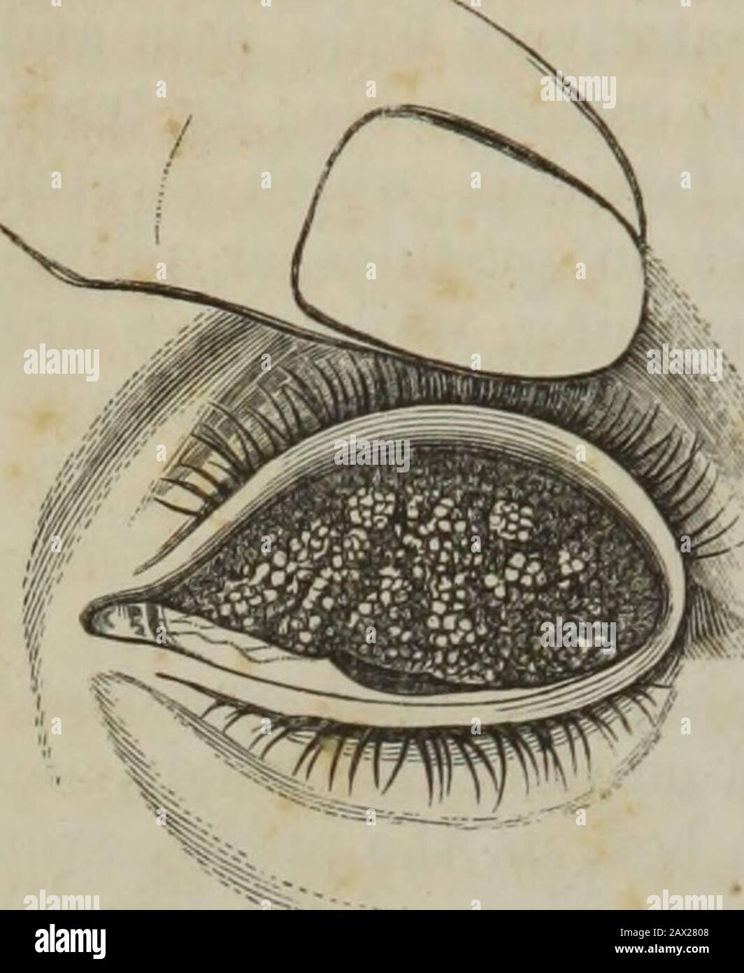 Morbid sensibility hi-res stock photography and images - Alamy