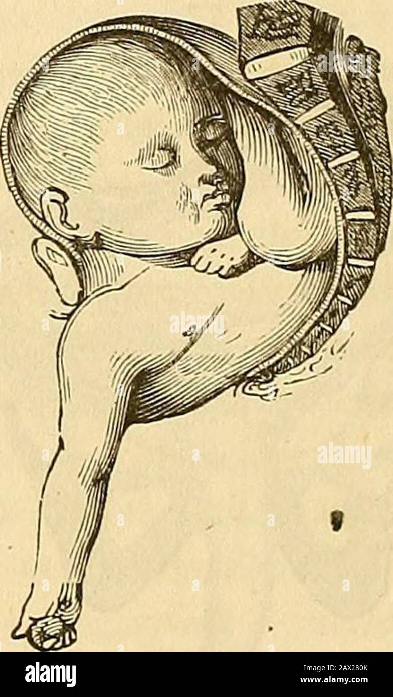 A theoretical and practical treatise on midwifery : including the ...