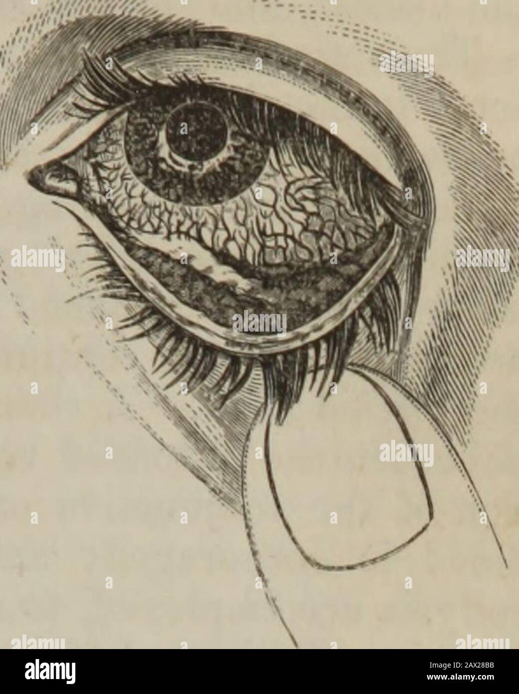 The practice of surgery . se are the Simple Purulentand Strumous ...