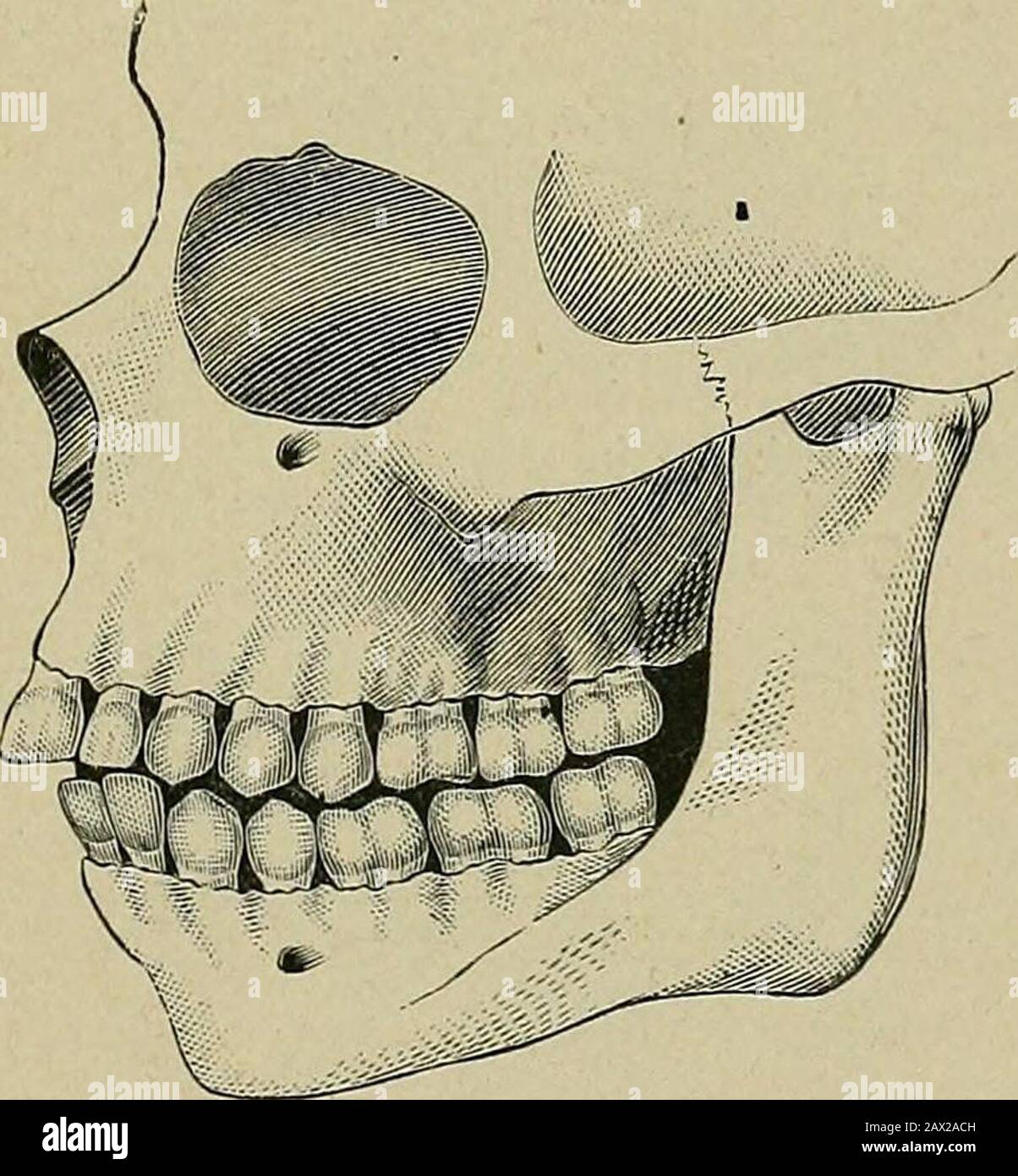 Upperteeth hi-res stock photography and images - Alamy