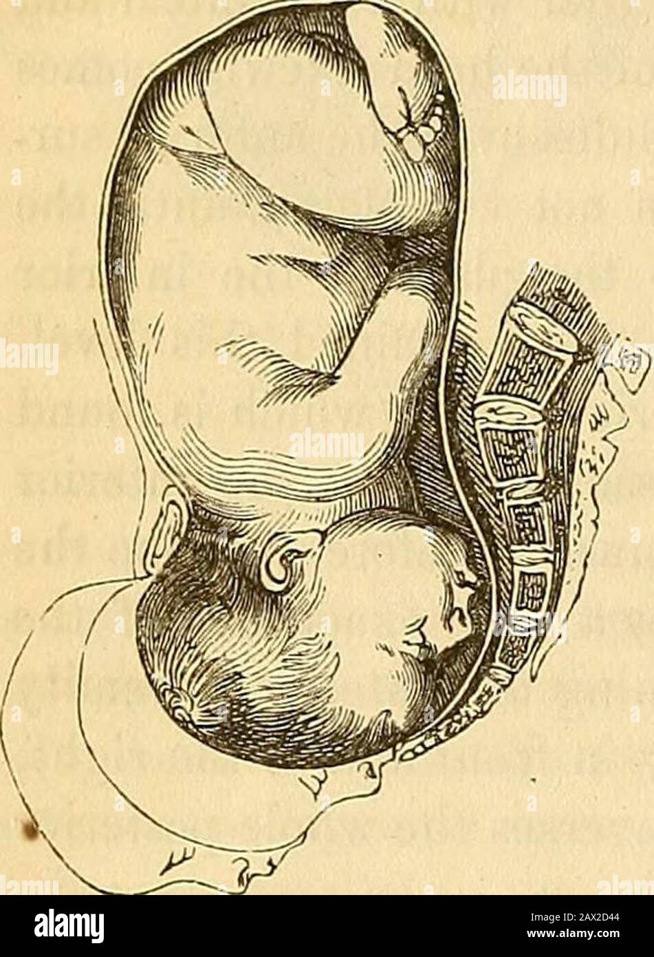 Occiput anterior hi-res stock photography and images - Alamy