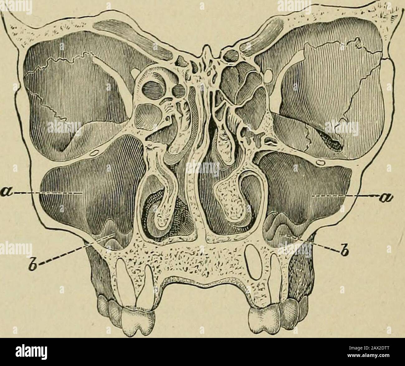 The etiology of osseous deformities of the head, face, jaws and teeth ...