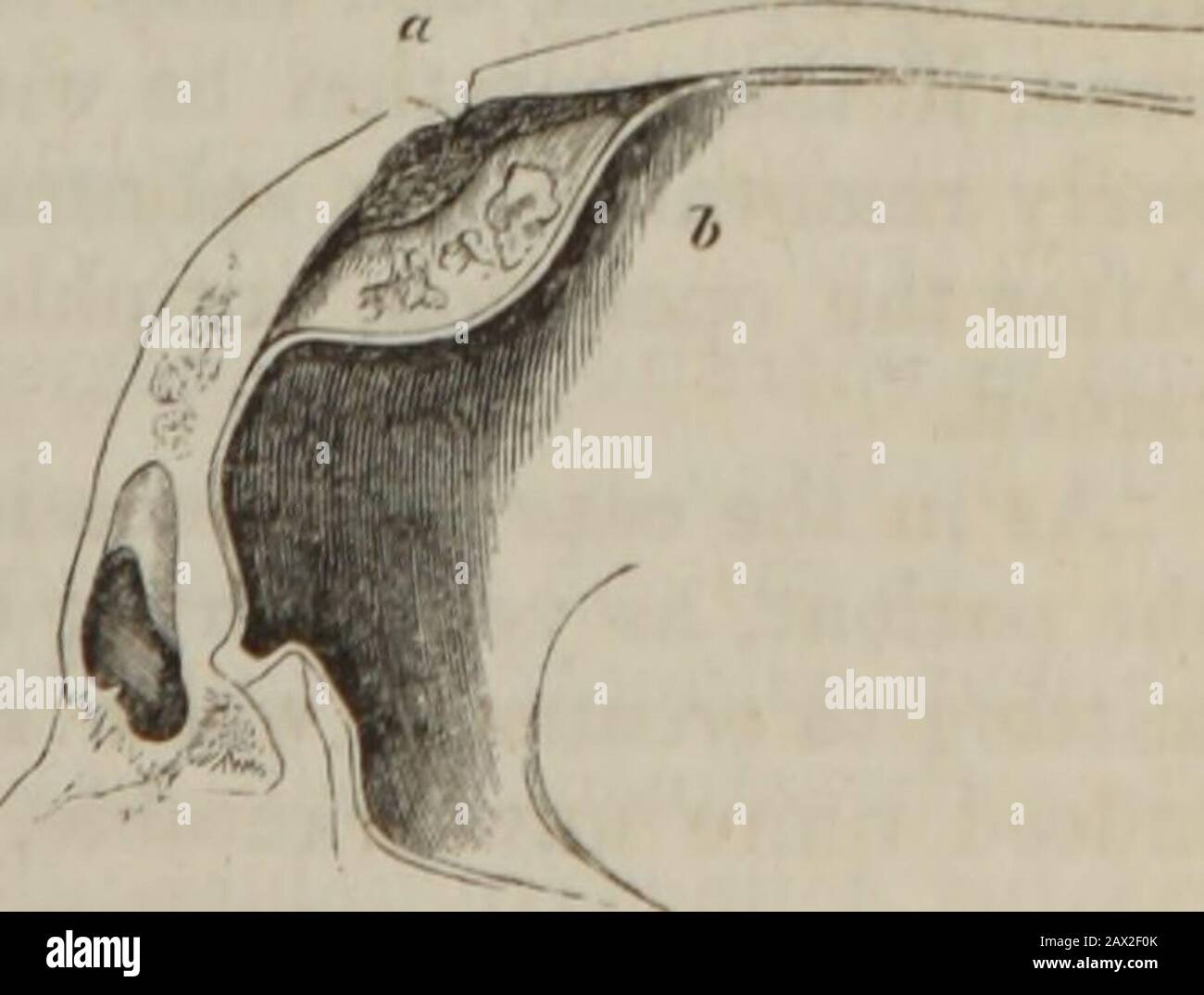 Skull thickness hi-res stock photography and images - Alamy