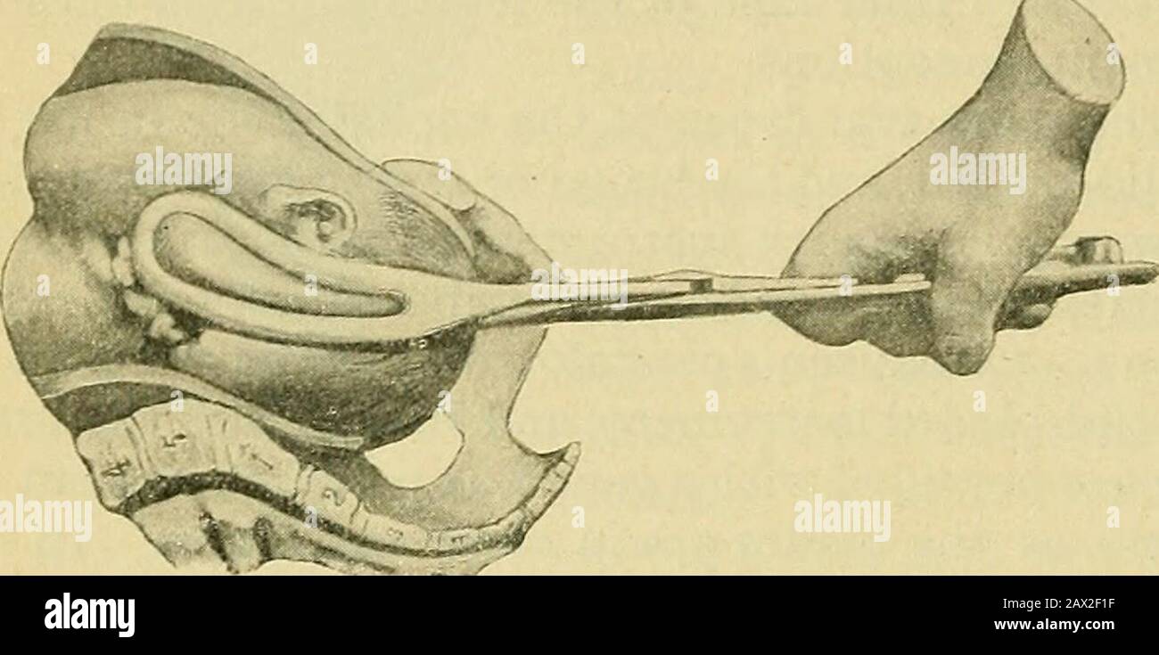 The practice of obstetrics, designed for the use of students and ...