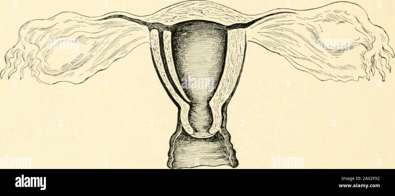 Polypi hi-res stock photography and images - Alamy