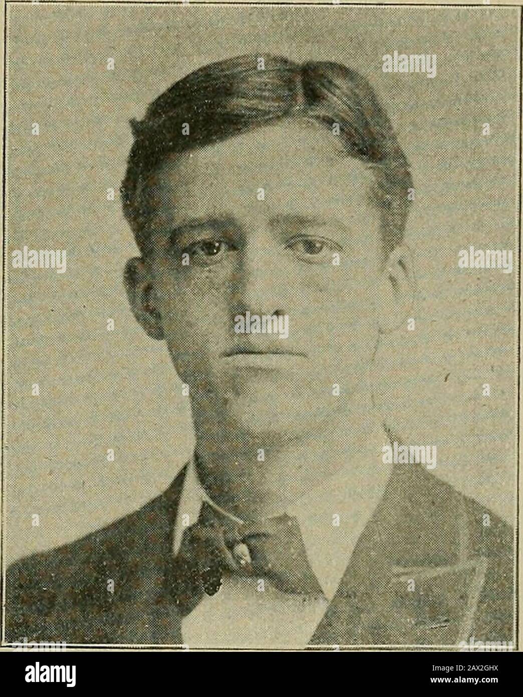 Deformity face hi-res stock photography and images - Alamy