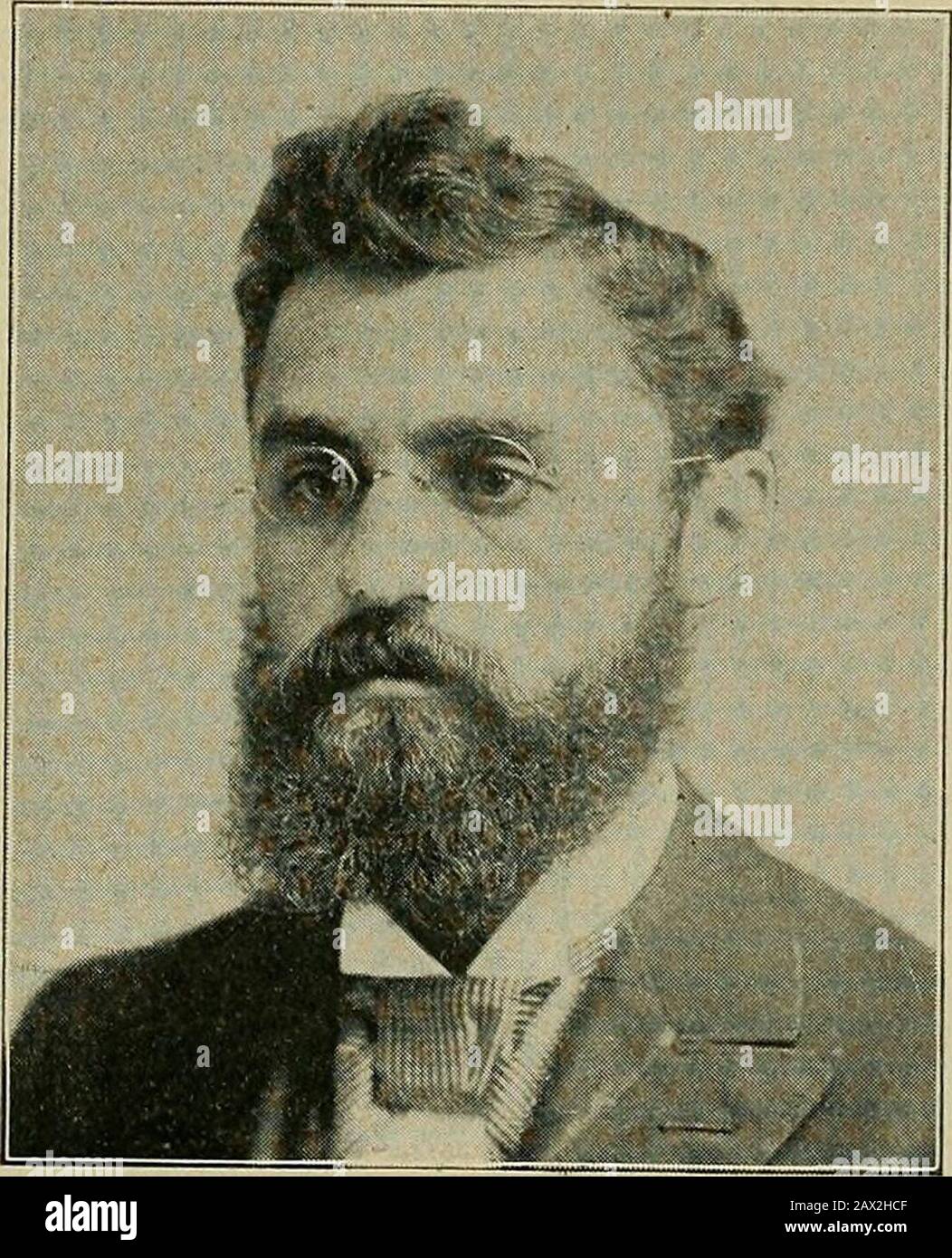 Dislocated jaws hi-res stock photography and images - Alamy