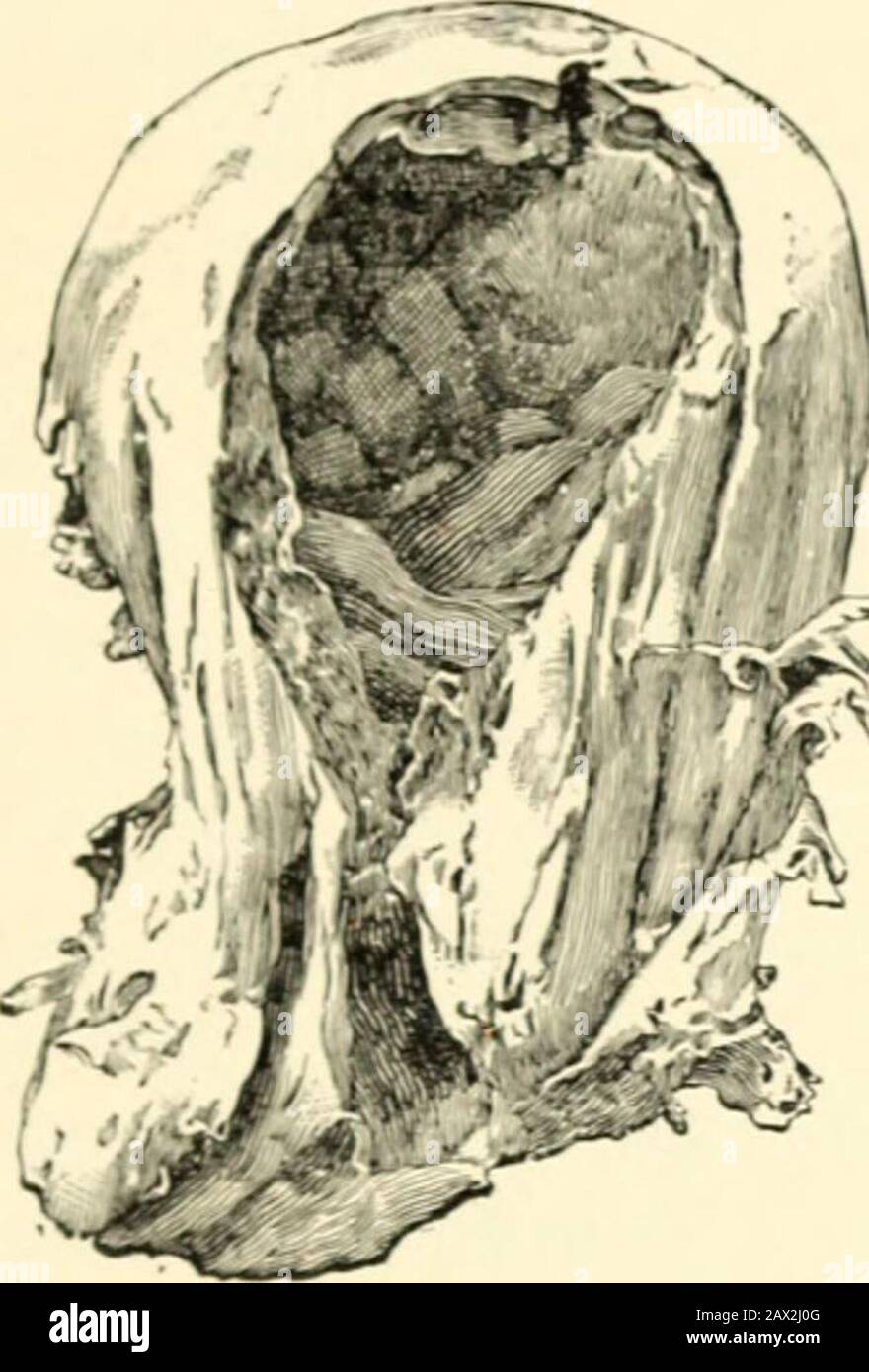 Placenta formation hi-res stock photography and images - Alamy