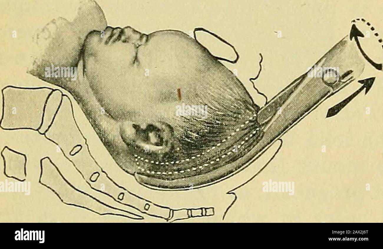 Occipito hi-res stock photography and images - Alamy