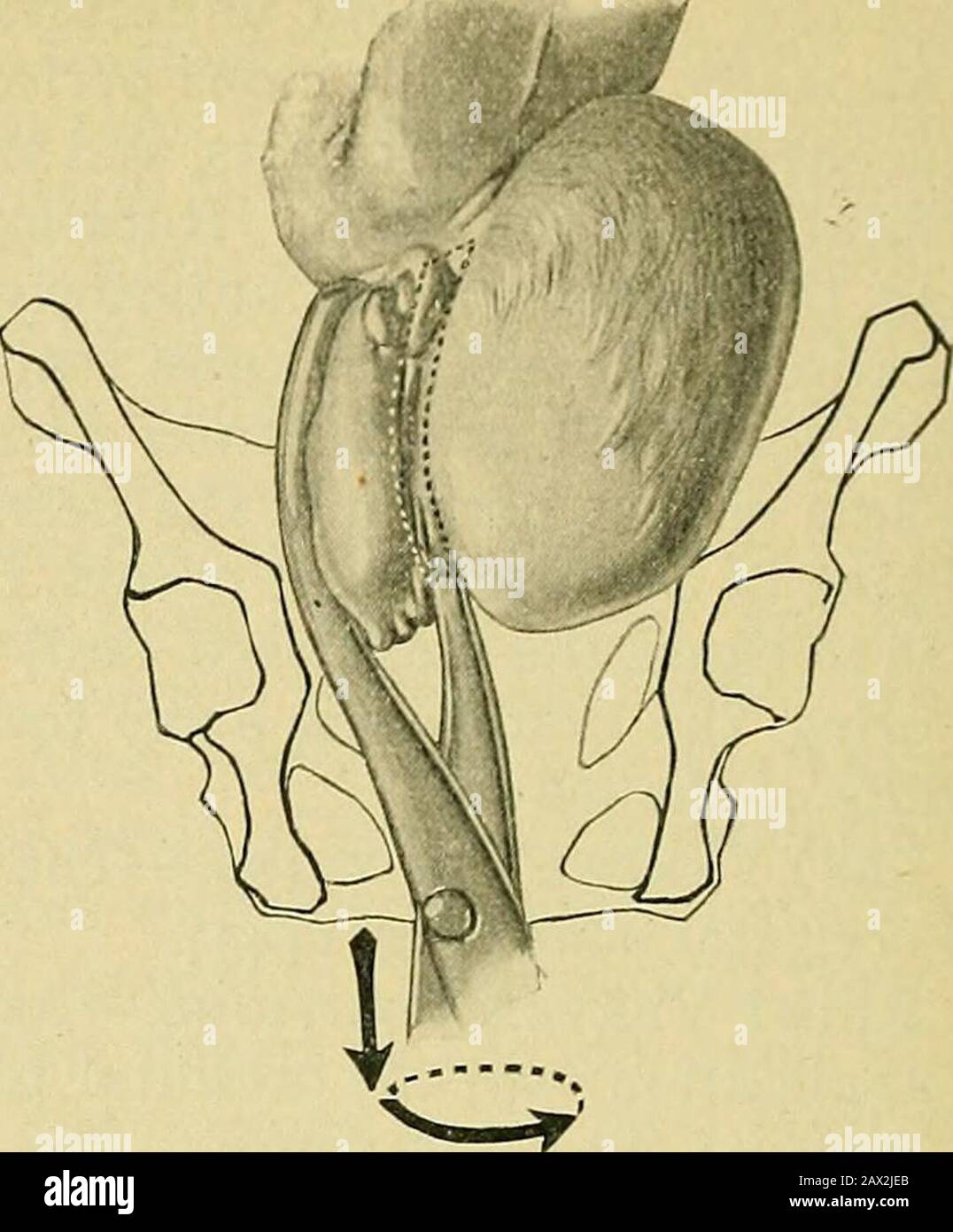 Occipito hi-res stock photography and images - Alamy