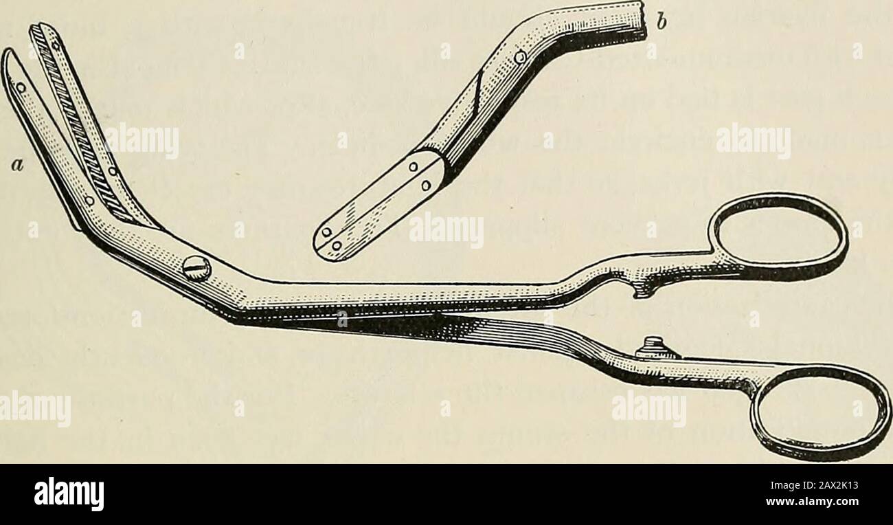 Salpingo oophorectomy hi-res stock photography and images - Alamy