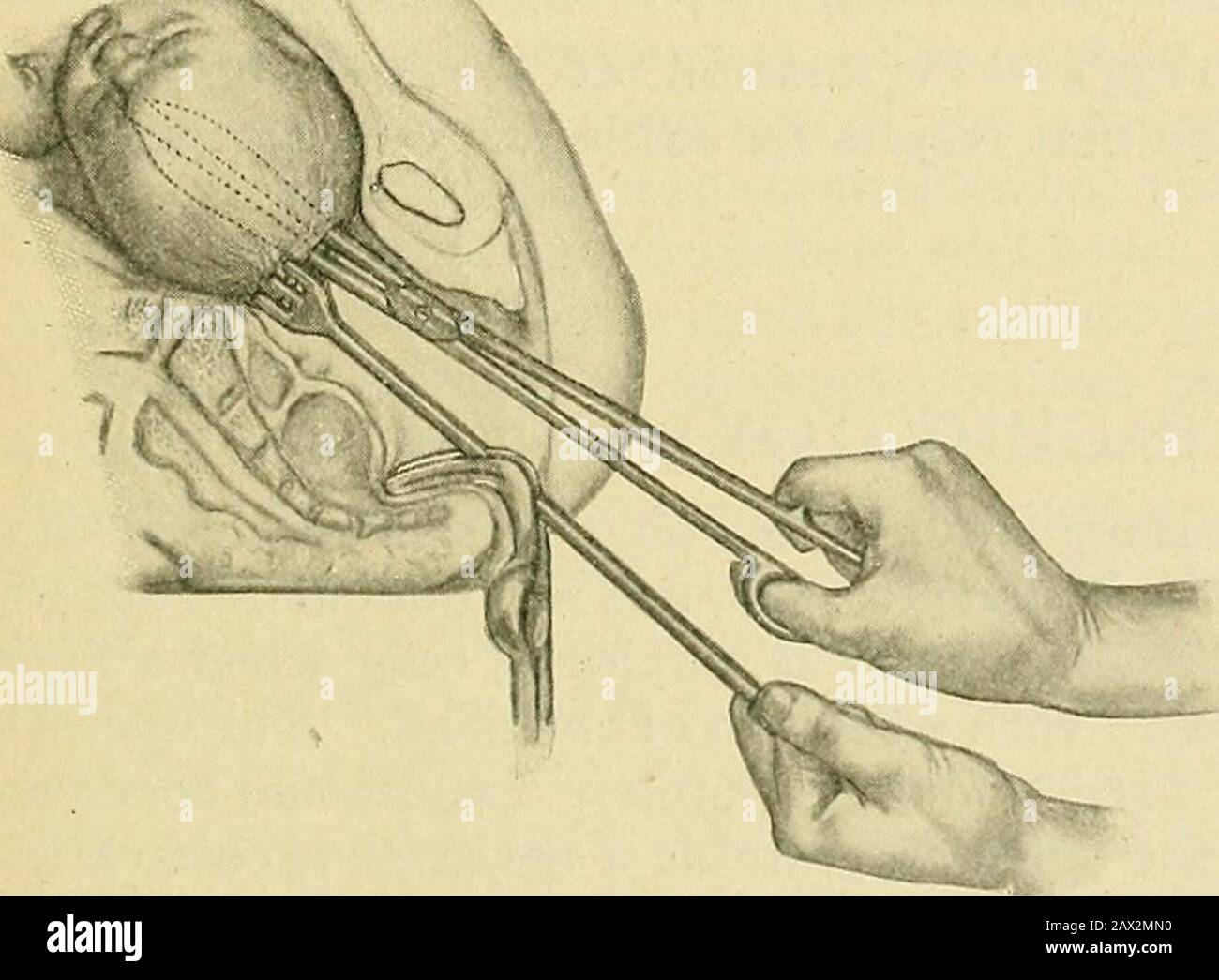 Crank shank hi-res stock photography and images - Alamy