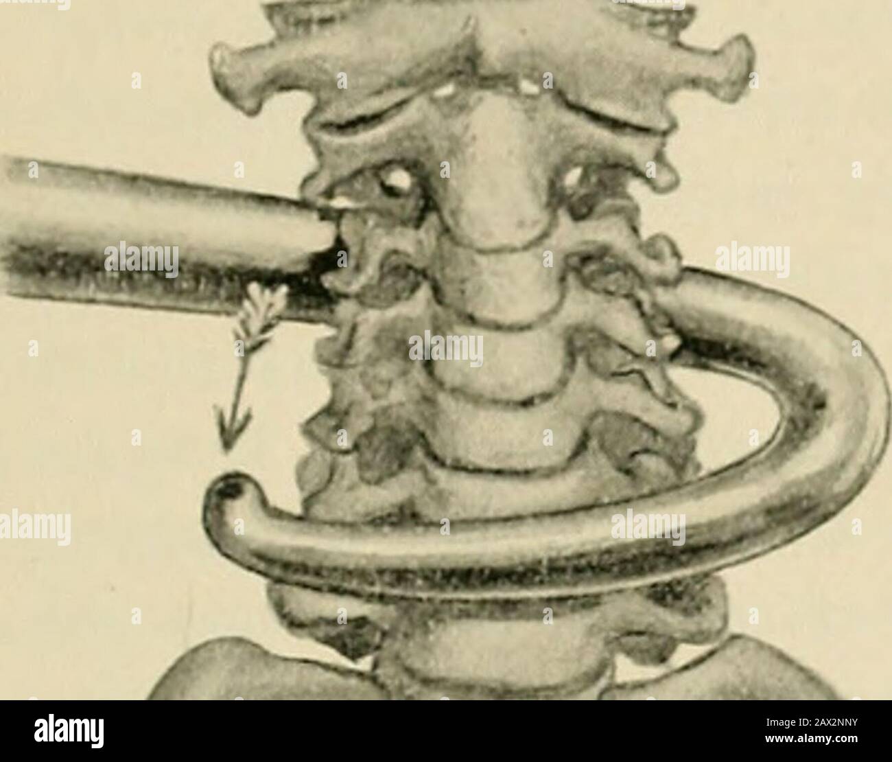 Breech Tape High Resolution Stock Photography and Images - Alamy