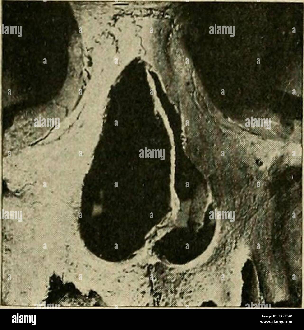 The etiology of osseous deformities of the head, face, jaws and teeth ...