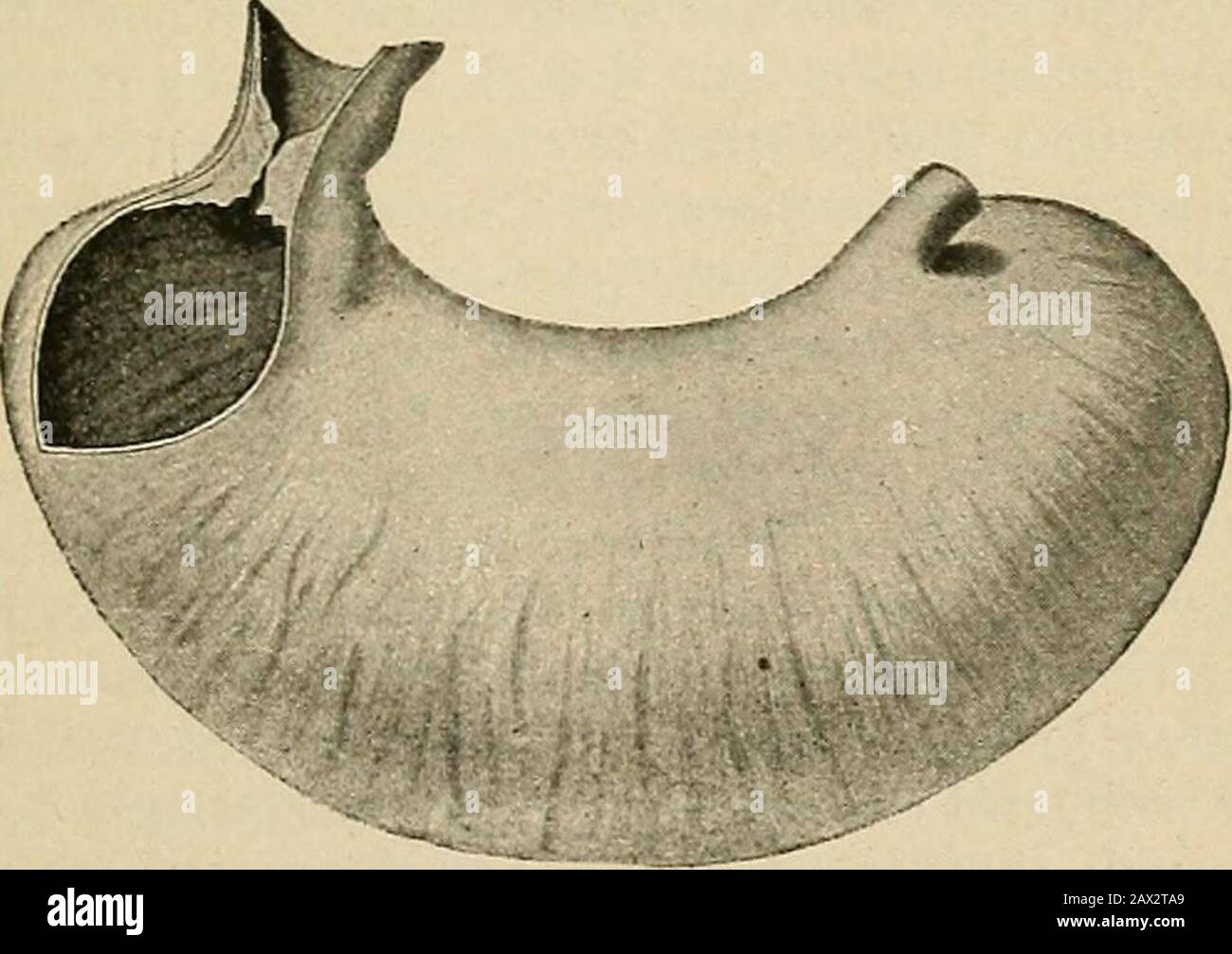 Surgery; its theory and practice . Male and female half of Murphys ...