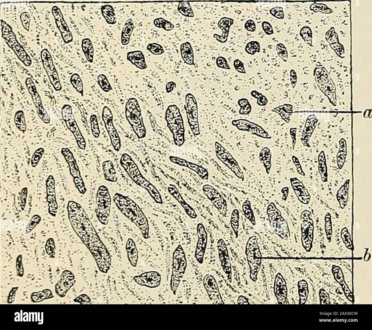 The pathology and surgical treatment of tumors . es is determinedby the ...